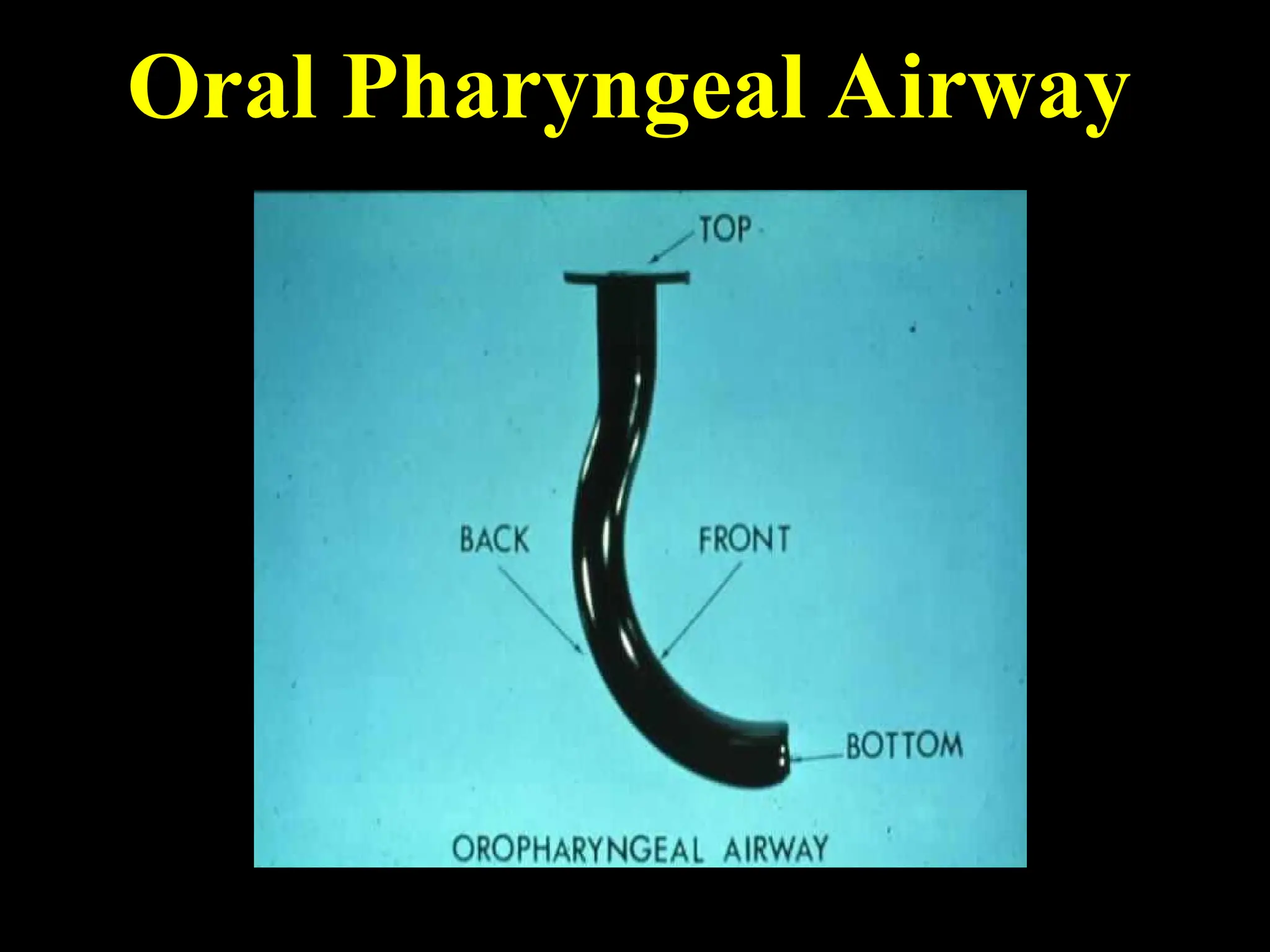 airwaymanagementuniversalsoldieraireway.ppt