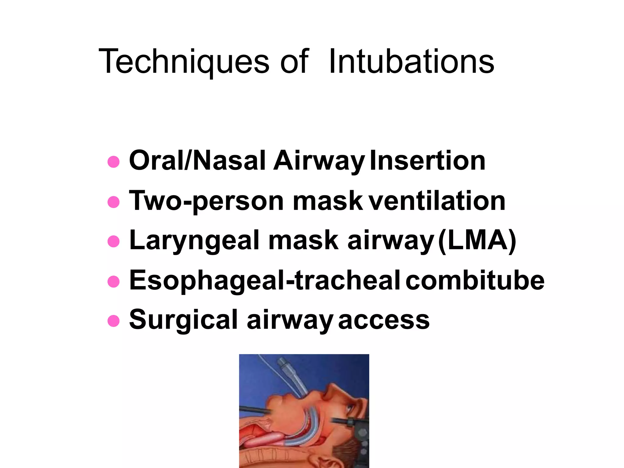 Airway management- INTUBATION.pptx