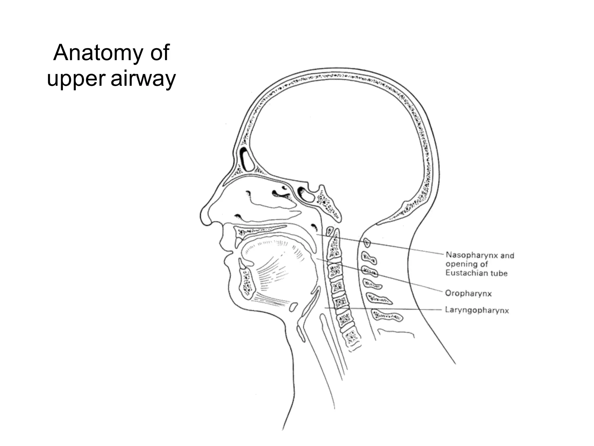 Airway management- INTUBATION.pptx
