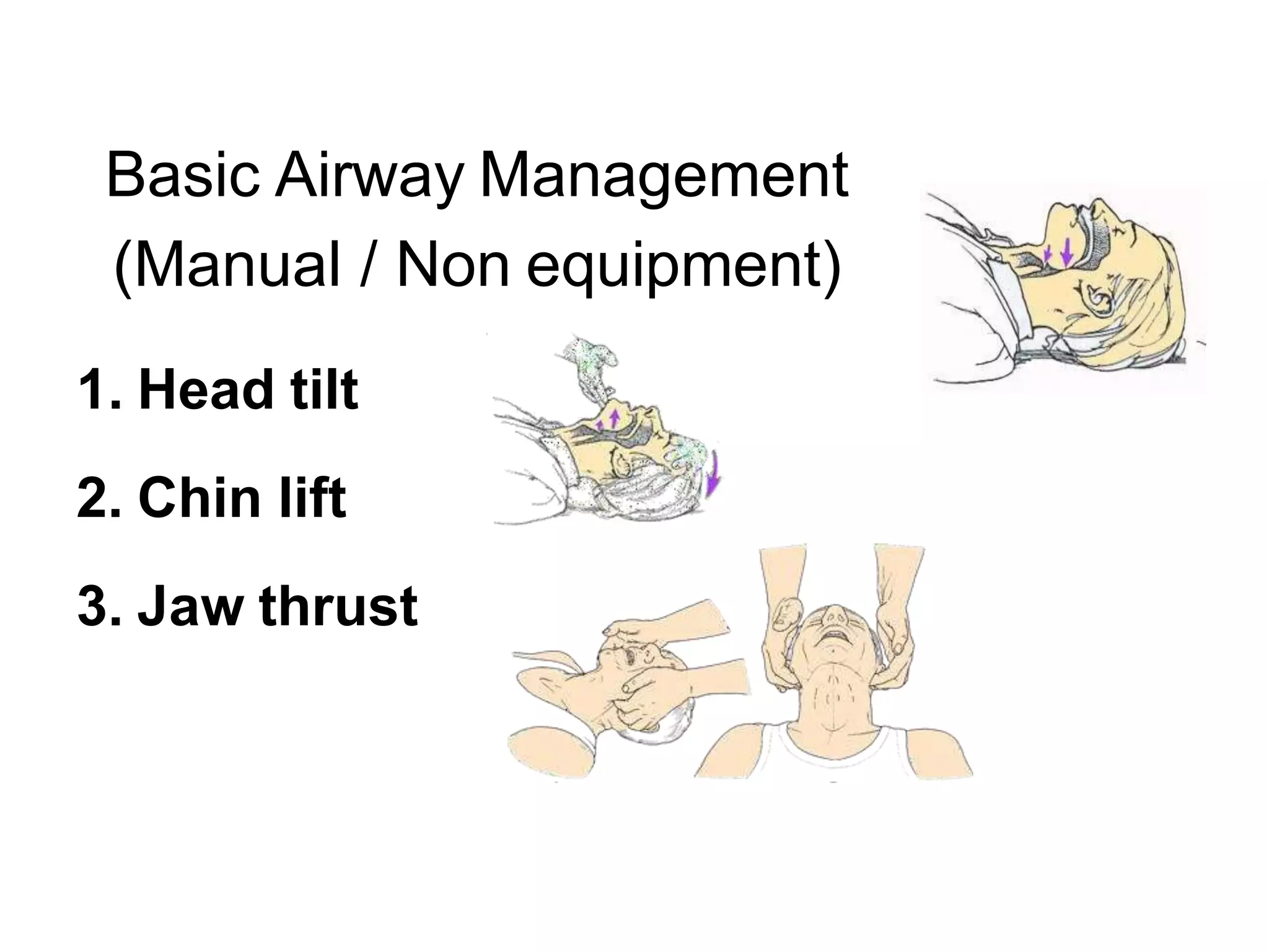 airwaymanagement-intubation-220330044725 (1).pdf