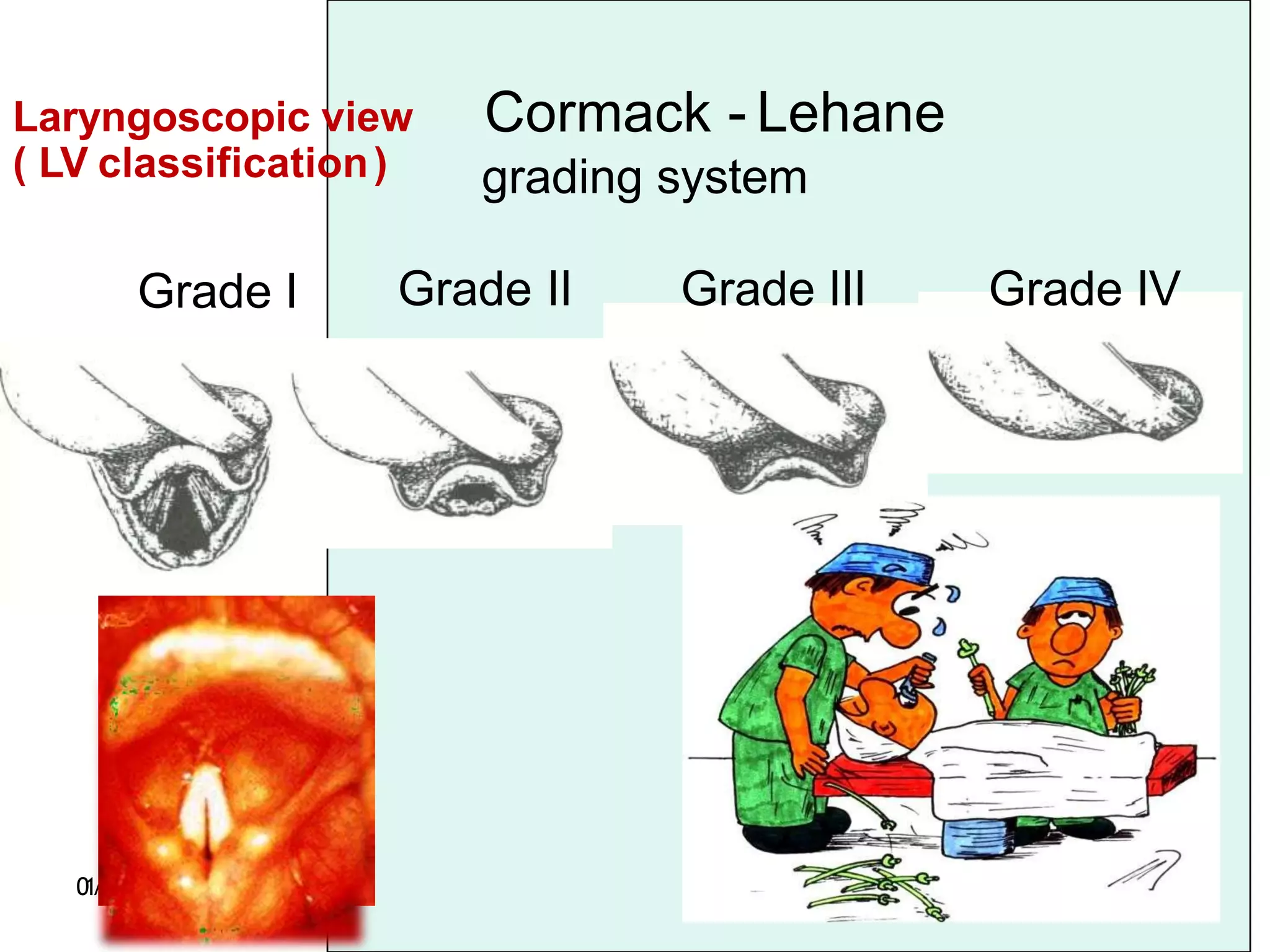 airwaymanagement-intubation-220330044725 (1).pdf