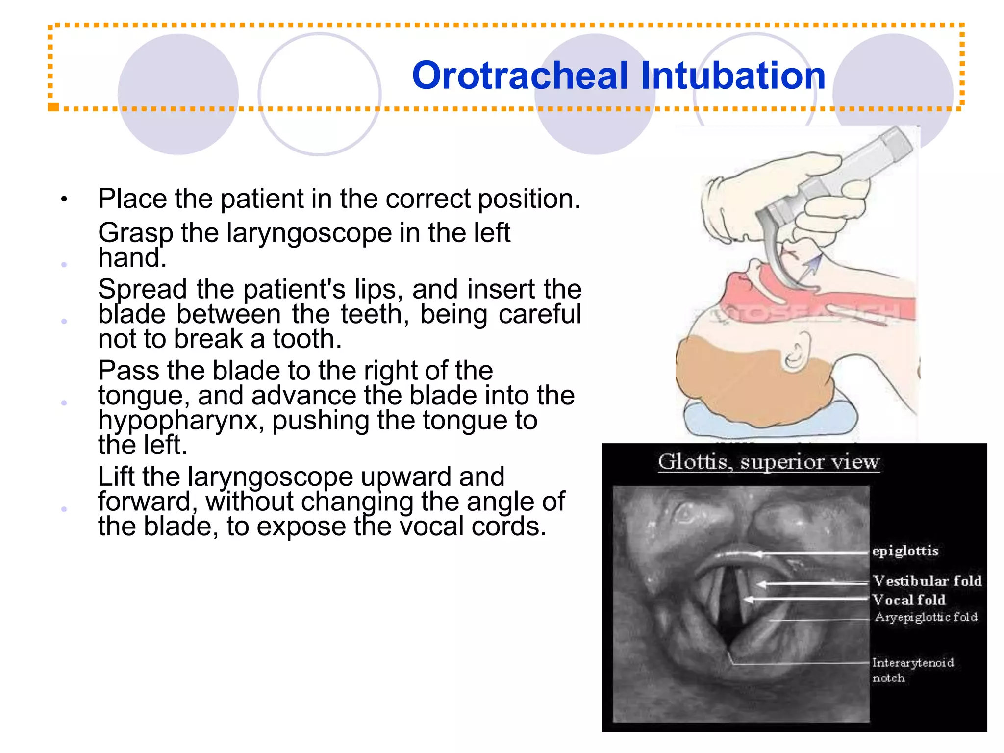 AIRWAY MANAGEMENT-INTUBATION (2).ppt