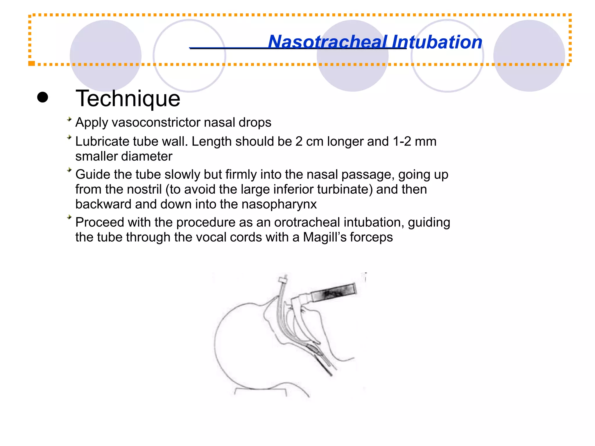 AIRWAY MANAGEMENT-INTUBATION (2).ppt