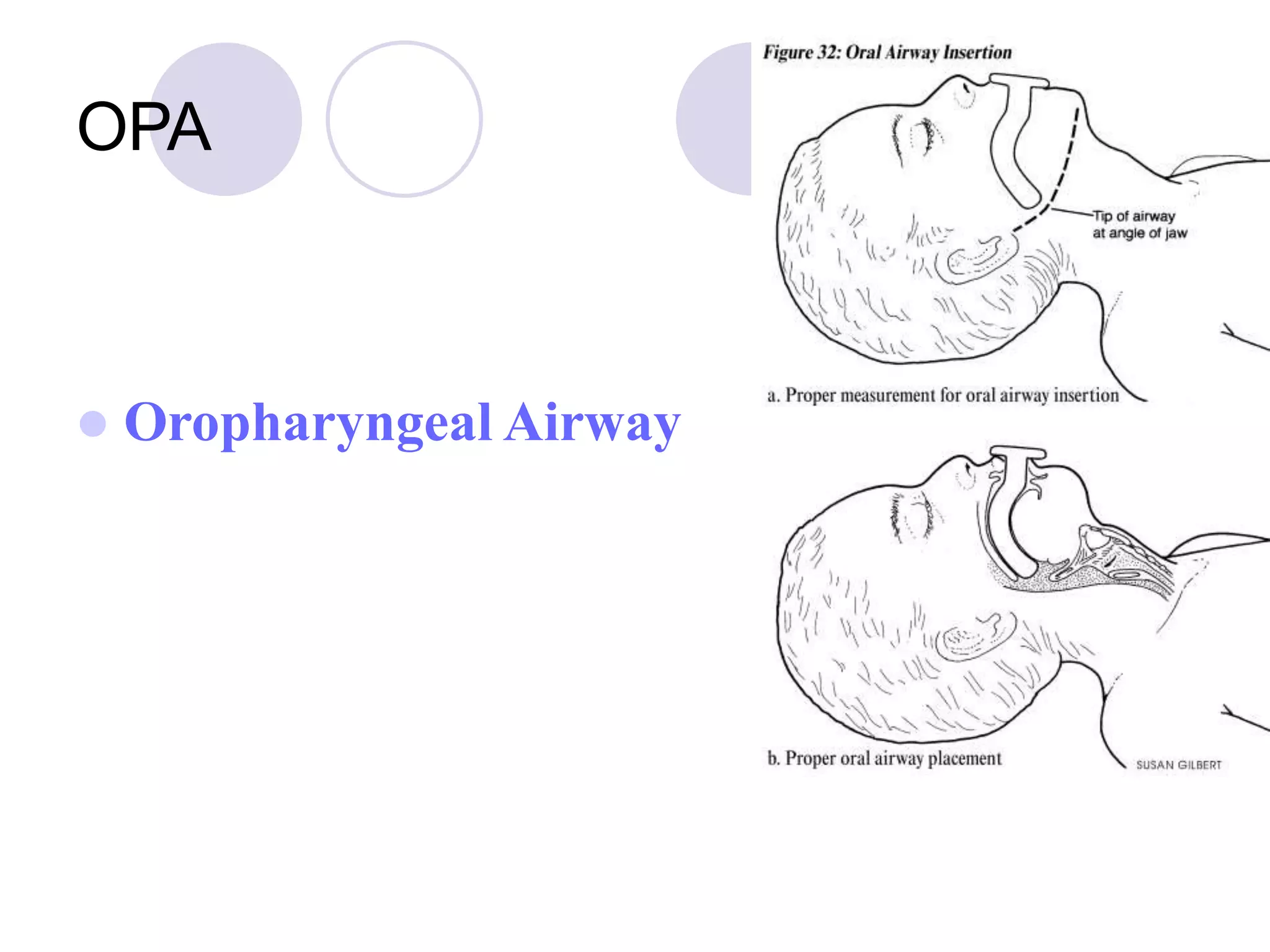 AIRWAY MANAGEMENT-INTUBATION (2).ppt