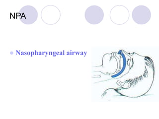AIRWAY MANAGEMENT-INTUBATION (2).ppt