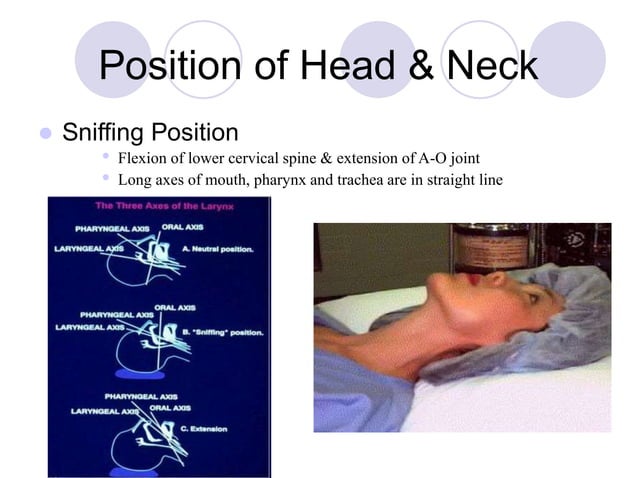 AIRWAY MANAGEMENT-INTUBATION (2).ppt | Ear, Nose and Throat Conditions ...