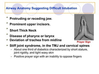 AIRWAY MANAGEMENT-INTUBATION (2).ppt