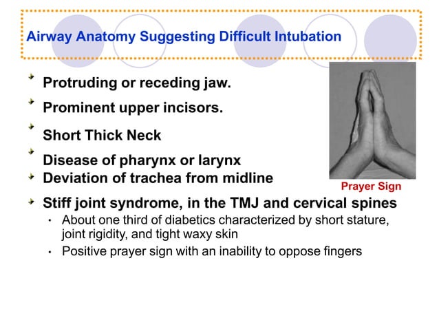 AIRWAY MANAGEMENT-INTUBATION (2).ppt | Ear, Nose and Throat Conditions ...