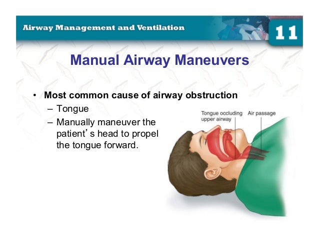 Airwaymanagement ppt-130122051436-phpapp02