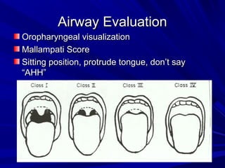Airway management | PPT