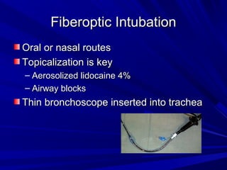 Airway management | PPT
