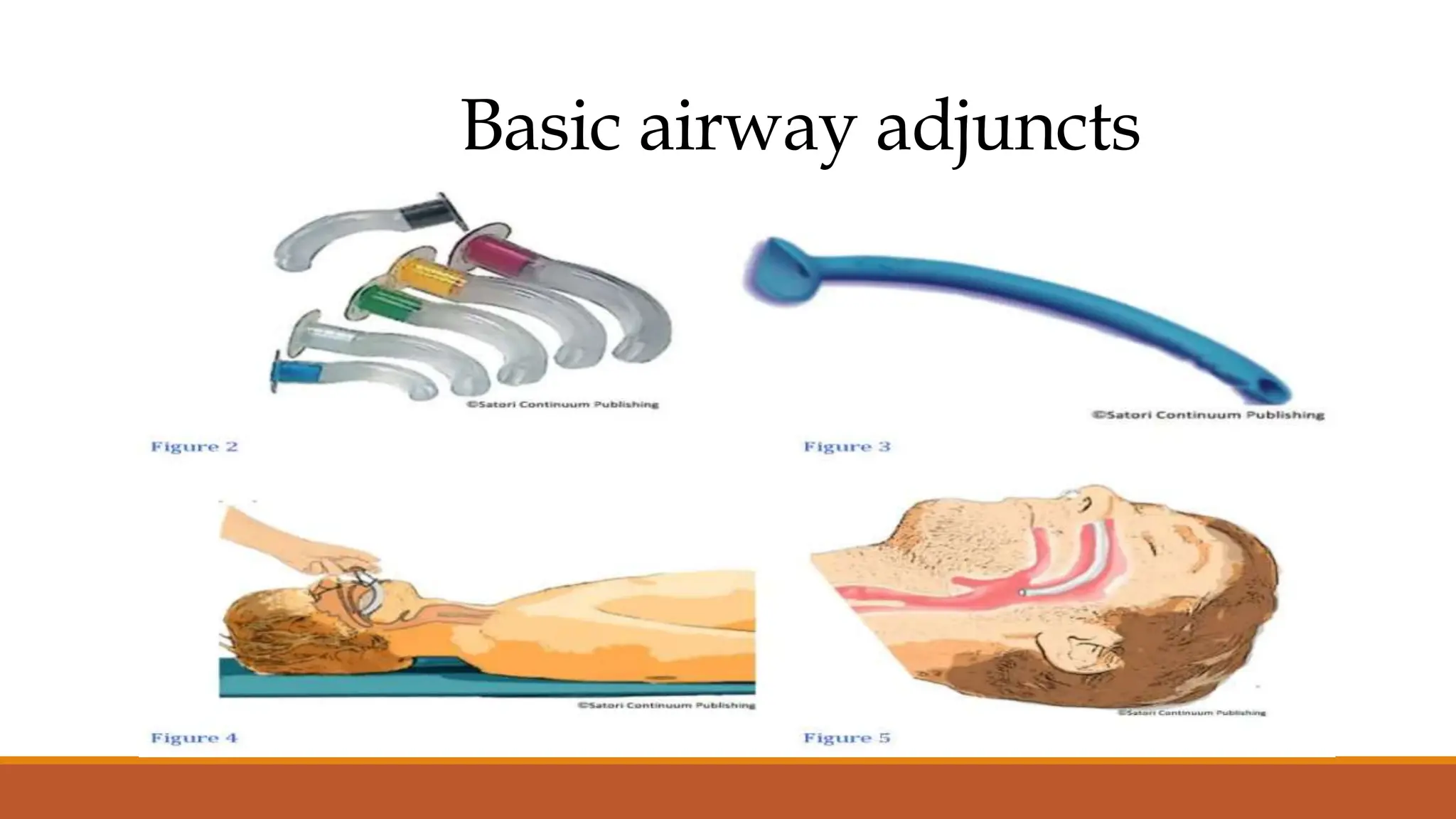 Airway Management and Intubation.pptx
