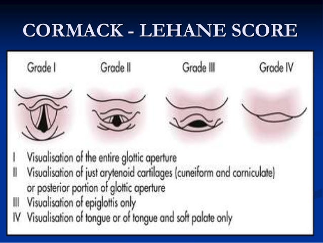 Airway management data show