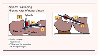 Airway Management Emergency department presentation .pptx