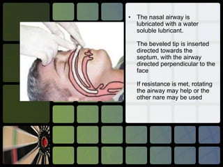 Airway management final | PPTX