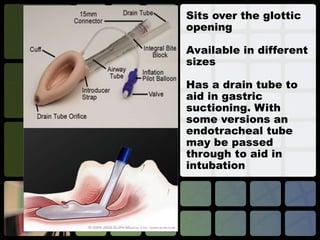 Airway management final | PPTX