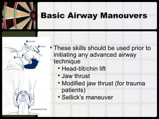 Airway management final | PPTX