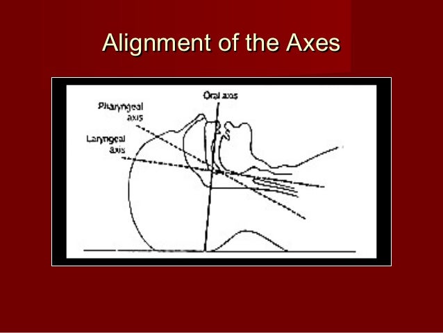 Airway management for lu6