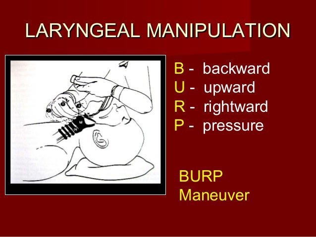 Airway management for lu6
