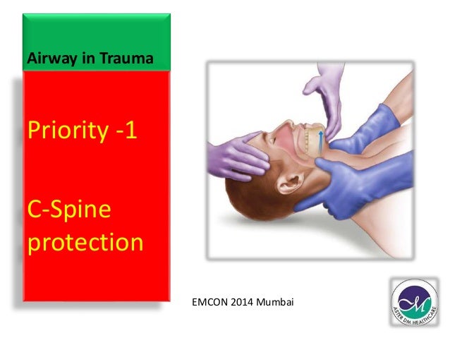 Airway management in acute trauma setting emcon14 upload version