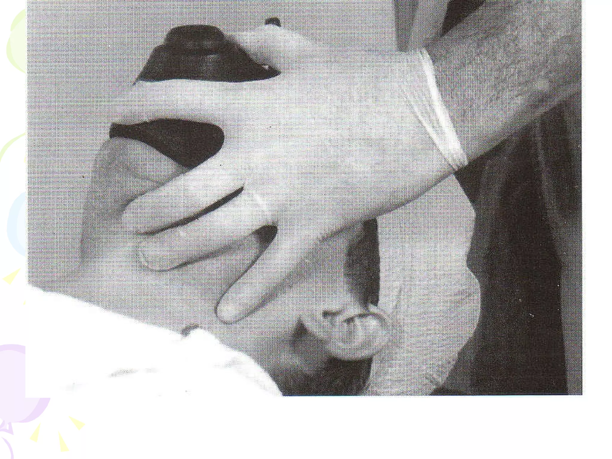 airway management in anaesthesia.pdf | Ear, Nose and Throat Conditions ...