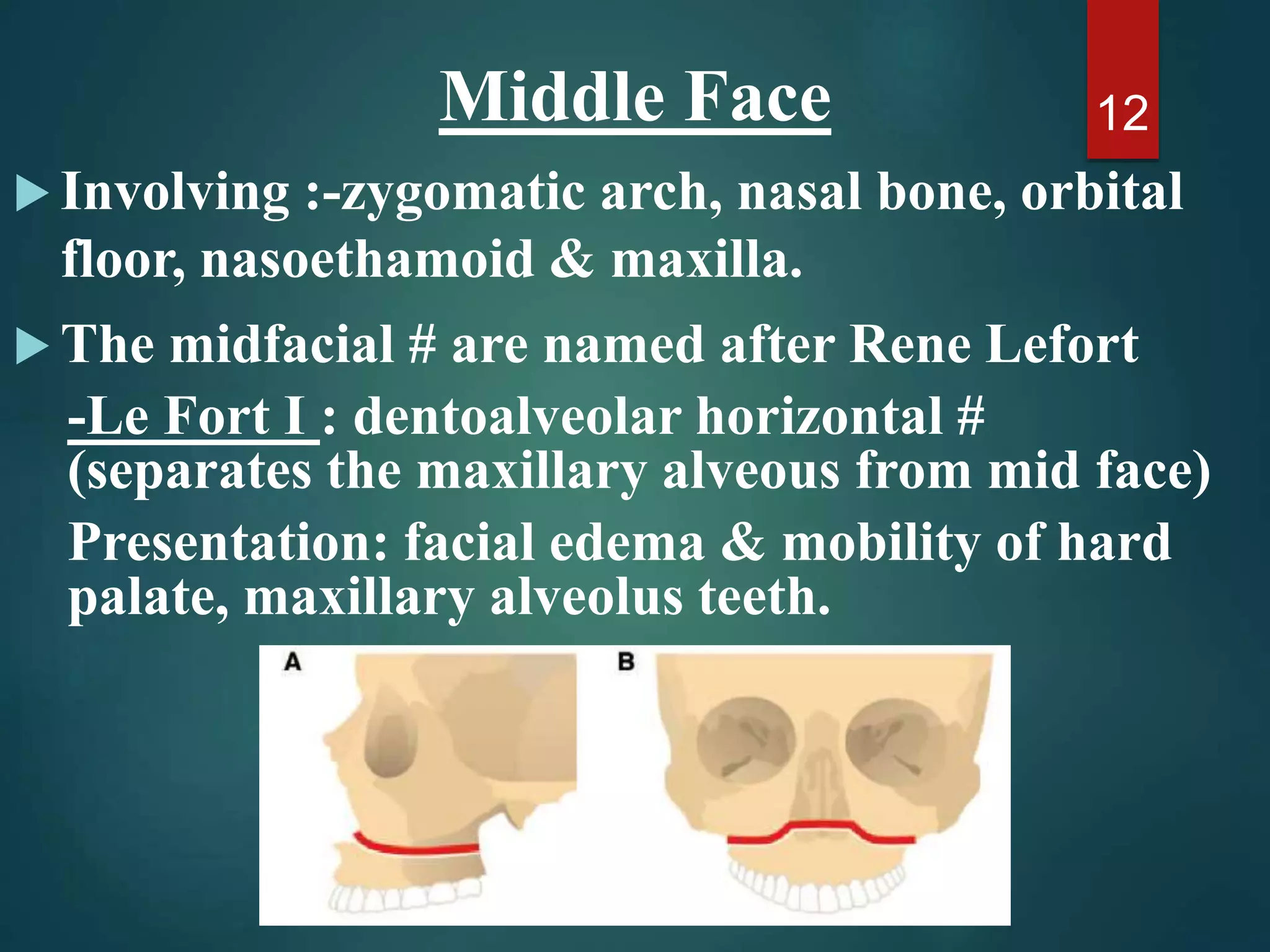 Airway management in maxillofacial trauma | PPTX