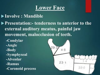 Airway management in maxillofacial trauma | PPTX