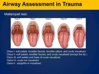 airwaymanagementintraumapatients-161007155246.pdf