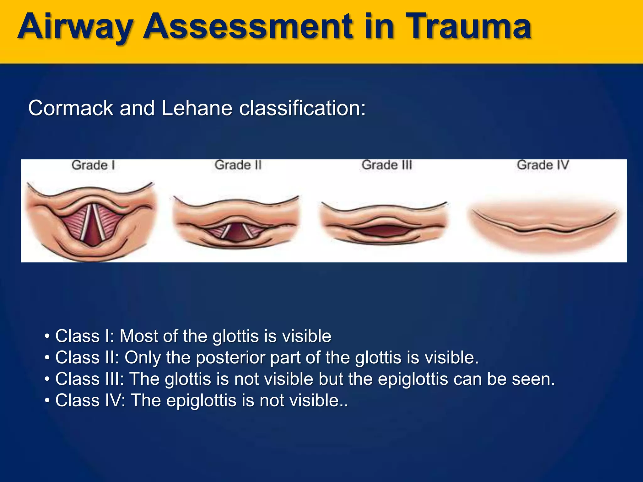 Airway management in trauma patients | PPTX