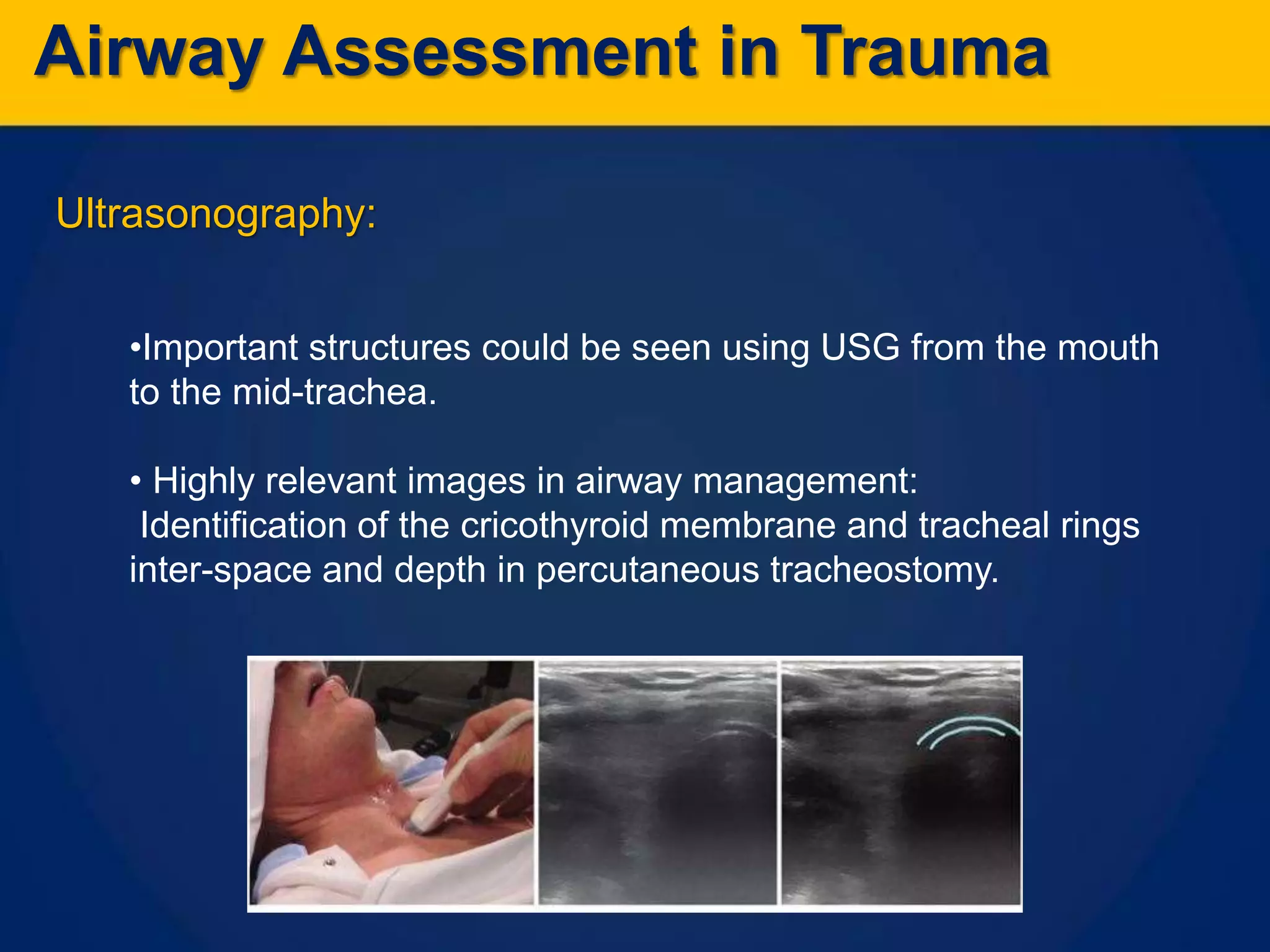 Airway management in trauma patients | PPTX
