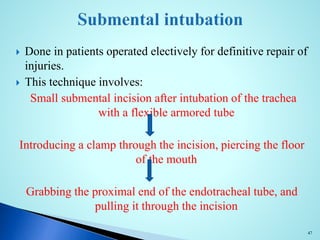 Airway management in trauma victims | PPTX