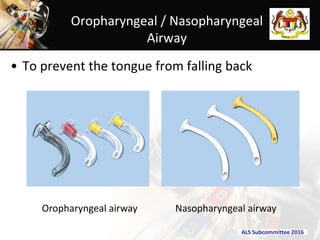 Airway management NCORT.pptx.upload presentation | PPTX