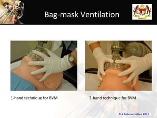 Airway management NCORT.pptx.upload presentation | PPT