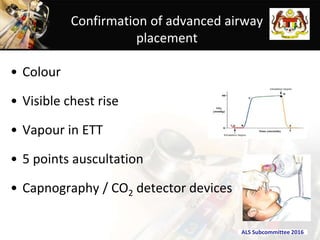 Airway management NCORT.pptx.upload presentation | PPTX