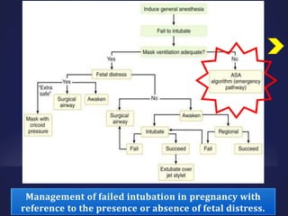 Airway Management of Pregnant Patient in Cesarean Section | PPTX