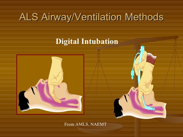 Airway management part 2