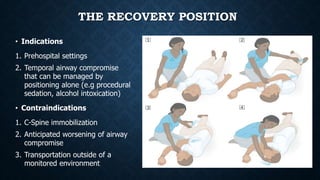 Airway management | PPTX