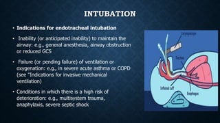 Airway management | PPTX