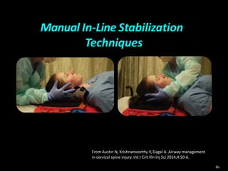 Airway management TBI and Cervical spine injury DVN.pptx