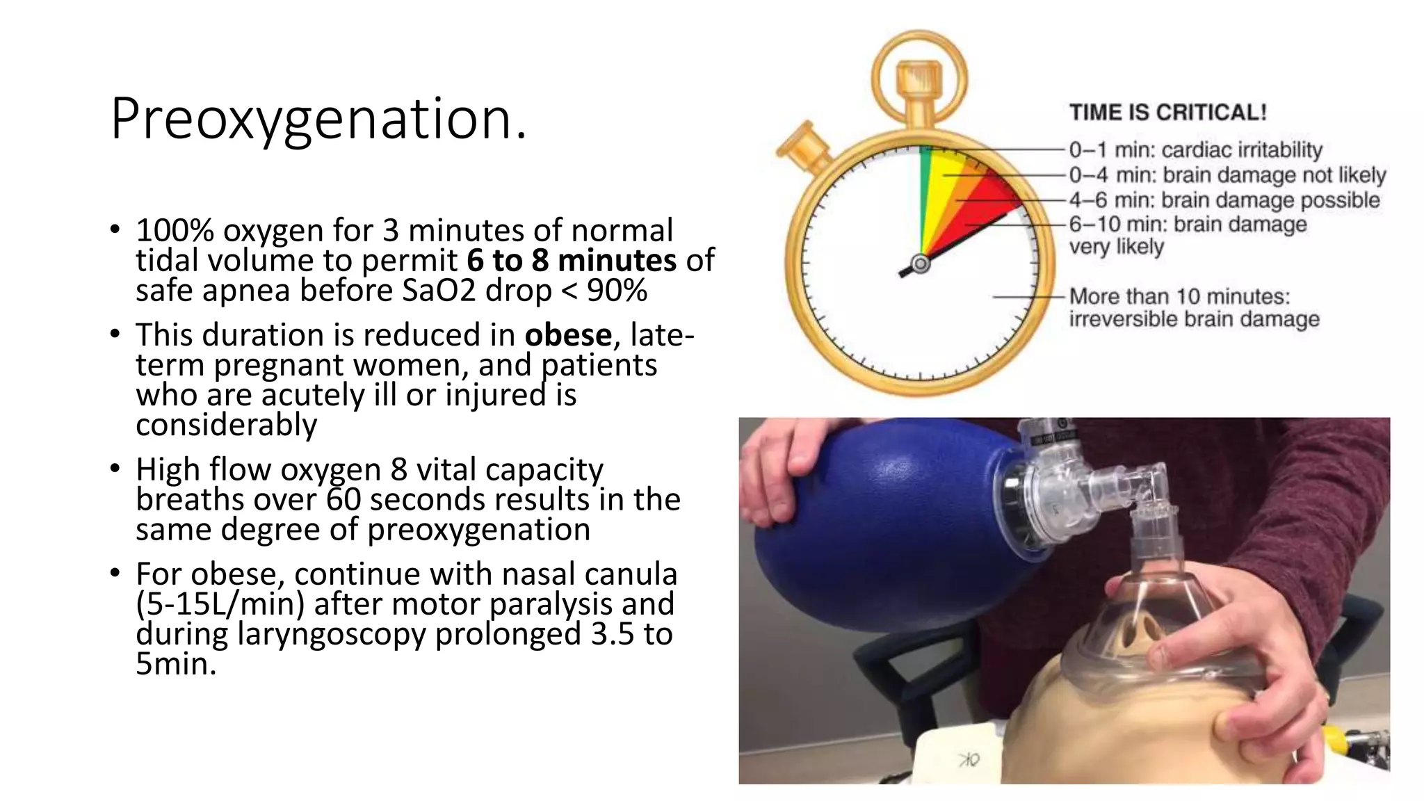 Airway management techniques by Dr Than Vutha | PPTX