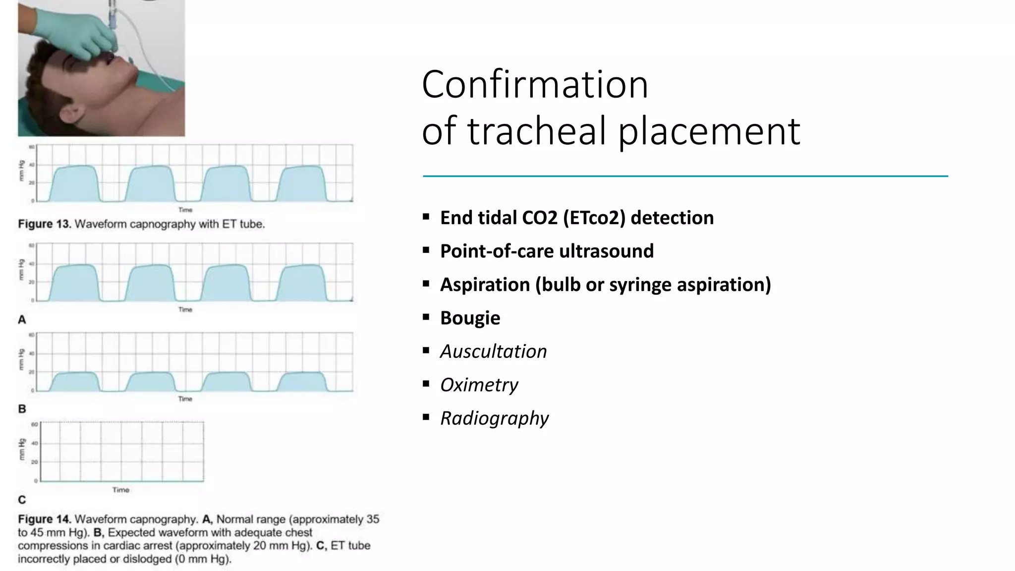 Airway management techniques by Dr Than Vutha | PPTX
