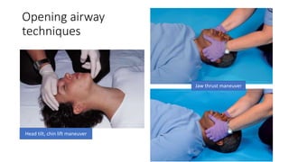 Airway management techniques by Dr Than Vutha | PPT