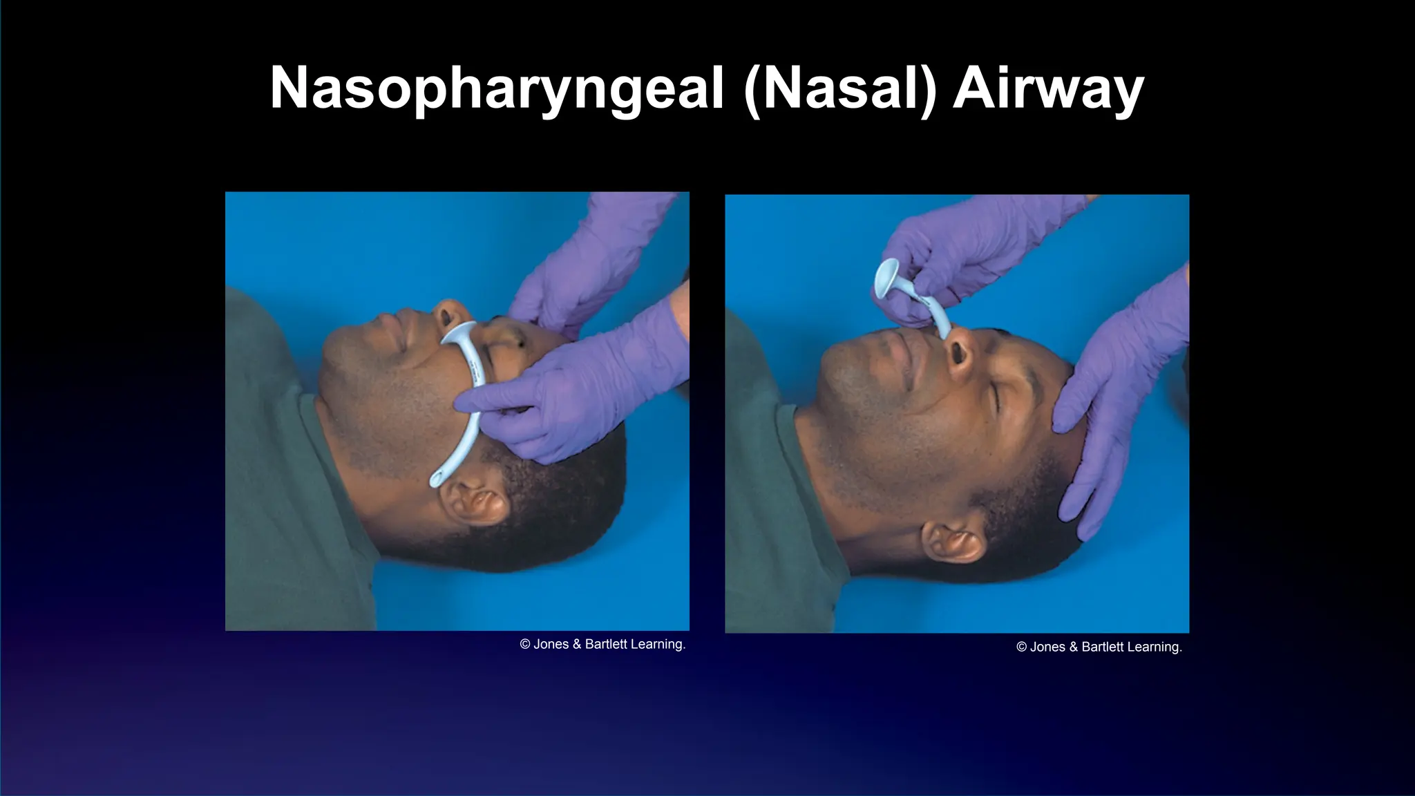 airway_managment emergency intubation and .pptx