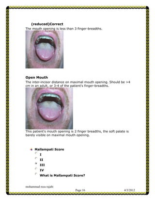 Airway manegement | PDF