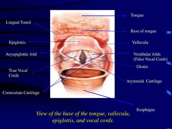 Airway management