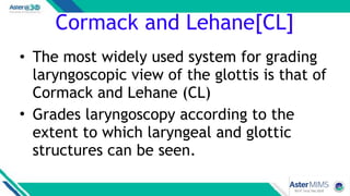 Airway management in ER @ nbe presentation 2017 | PPT