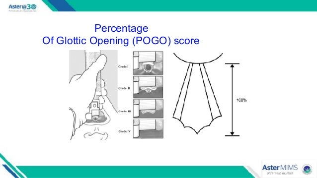 Airway management in ER @ nbe presentation 2017