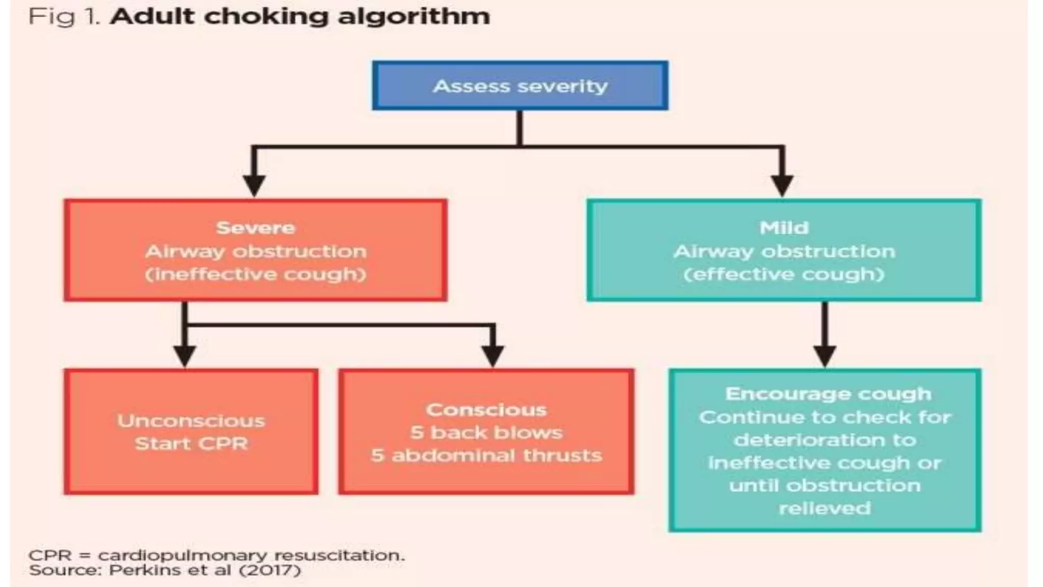 Airway obstruction | PPTX