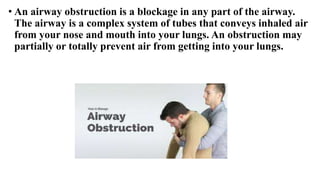 Airway obstruction | PPTX