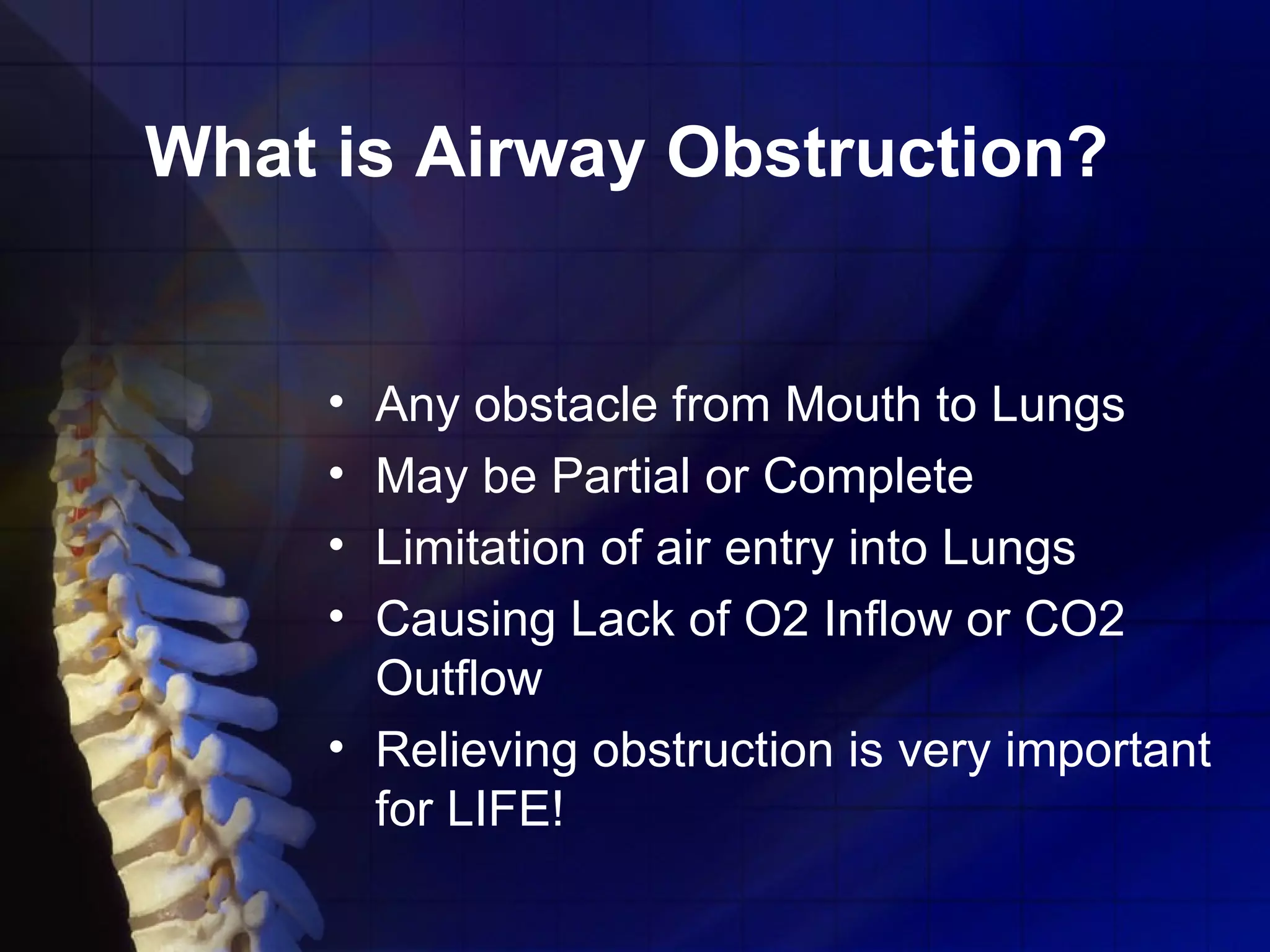 Airway obstruction and management | PPT